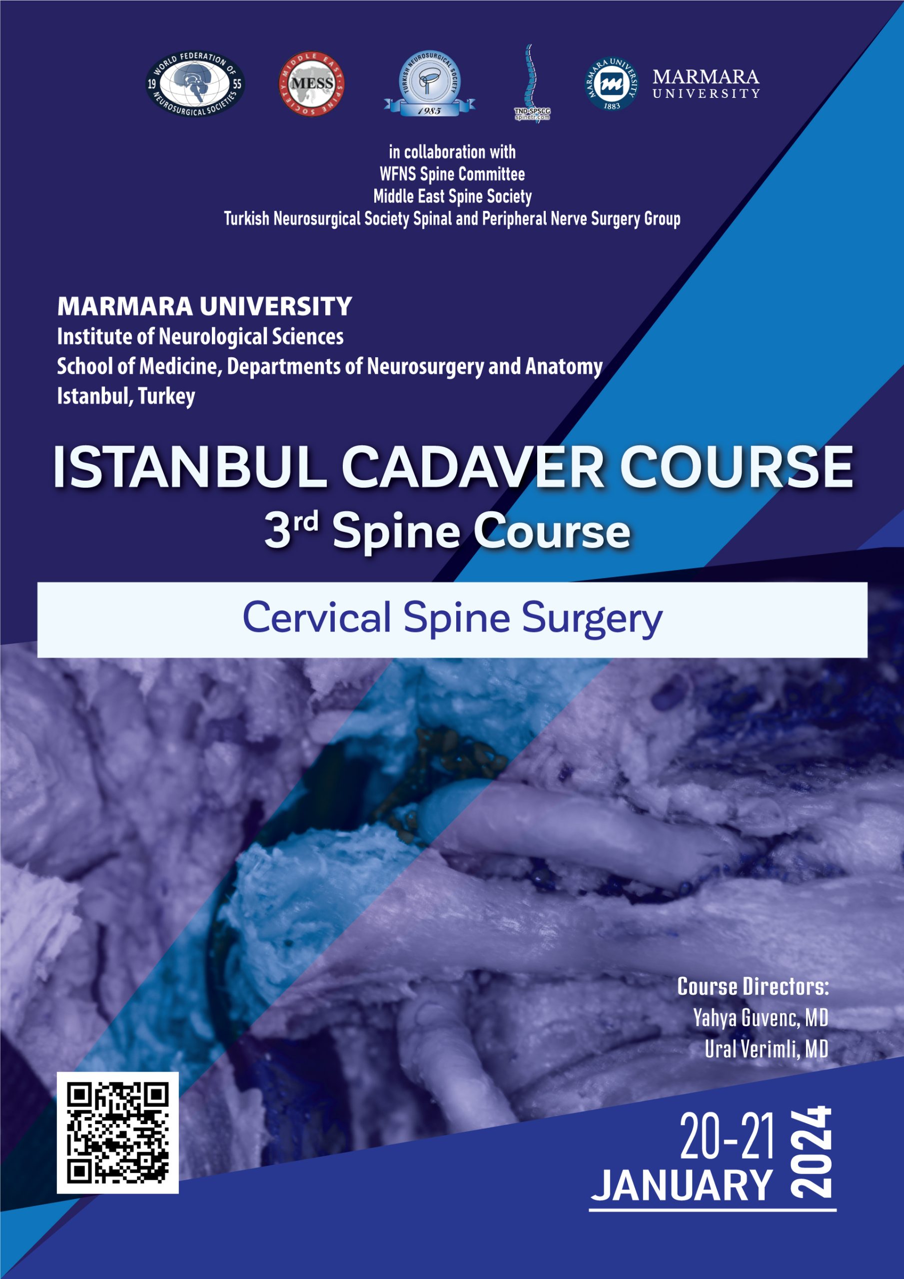 Istanbul Cadaver Course – Spine – Thoracic, Lumbar Sacral Spine Surgery ...